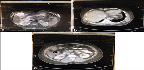 Saudi Surgical Journal
