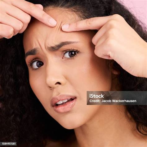 스킨케어 여성 여드름 또는 분홍색 스튜디오 배경의 자연미에 문제가 있습니다 얼굴 체크 및 여드름 또는 여드름 또는 여드름을 가진 소녀 또는 자기 관리를 위한 미용 또는