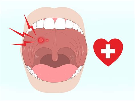 Red Dots On The Inside Of Your Lip