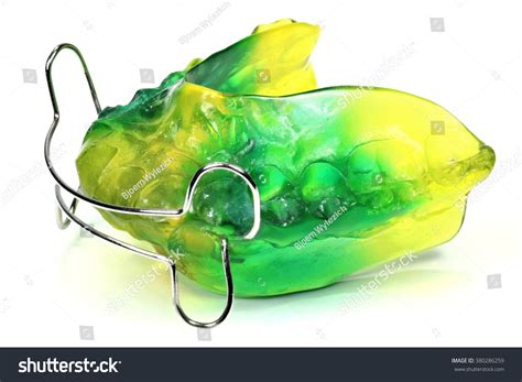 Overbite Correction With Retainers