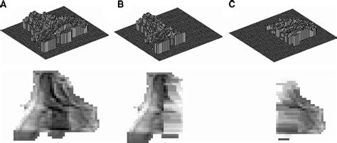 Figure 2 From Optimal Field Splitting Algorithm In Intensity Modulated