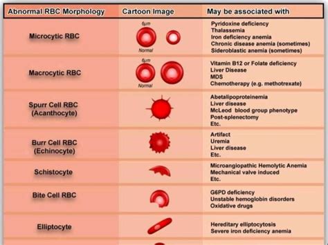Abnormal Rbcs Morphology With Most Common Causes
