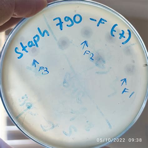 Staphylococcus Aureus Bacteriophage 152790f Mikroliz