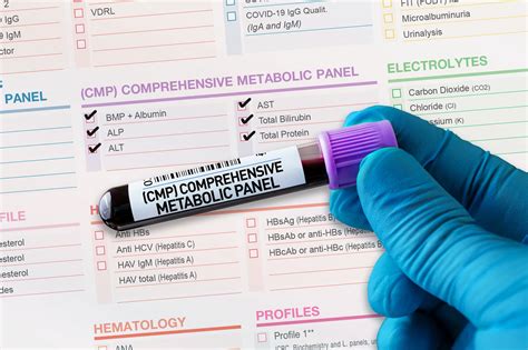 What Is A Normal Comprehensive Metabolic Panel CMP Result ARCpoint Labs Of San Rafael
