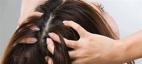 What To Do About A Dry Flaky Scalp CLEAR