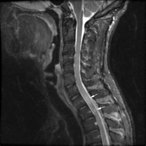 Manual Muscle Testing MMT Physical Exam Findings Download Scientific Diagram