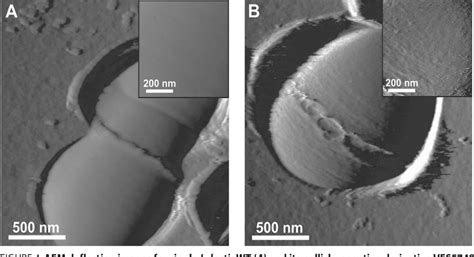 Figure 4 From Cell Surface Of Lactococcus Lactis Is Covered By A Protective Polysaccharide