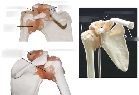 Shoulder Tendon Anatomy Diagram Shoulder Ligaments Bones And Tendons