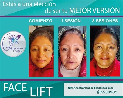 ¿sabías Que Cuando Anna Carten Facilitadora Access