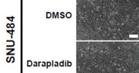 난치성 위암 치료 길 열리나 새 항암 치료물질 발굴 세상을 깨우는 발견