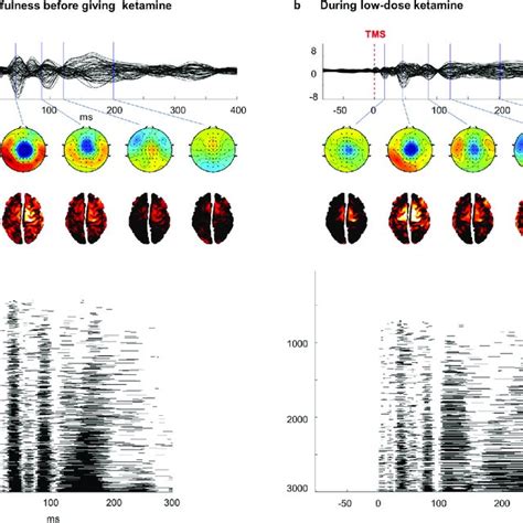 Spatiotemporal Dynamics Of Tms Eeg Responses In Normal Wakefulness Download Scientific Diagram