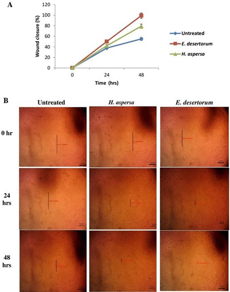 Scratch Wound Healing Assay A Percentage Of Wound Closure At 0 24