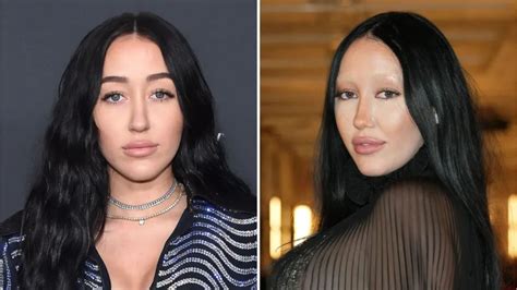 Noah Cyrus Plastic Surgery Before And After Transformation