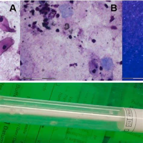 Top Microscope Slide Sections 400x Magnification Captured From Download Scientific Diagram