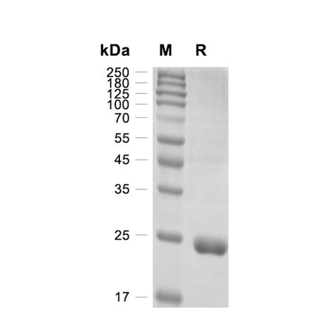 Abhd14b Protein Human His Medchemexpress