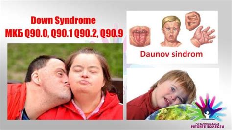 ГИ ЗАПОЗНАВАМЕ РЕТКИТЕ БОЛЕСТИ ДАУНОВ СИНДРОМ Сакам Да Кажам