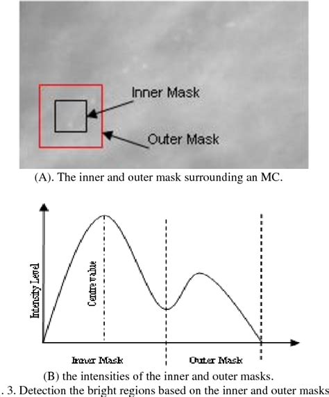 Figure 1 From Automatic Microcalcification Detection Using Wavelet Transform Semantic Scholar