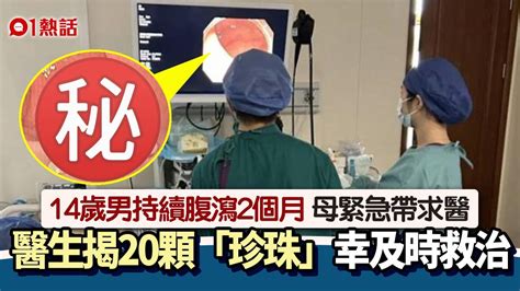 慎入！14歲男腹瀉2個月 醫生驚揭體內「20顆珍珠」 最後咁解決