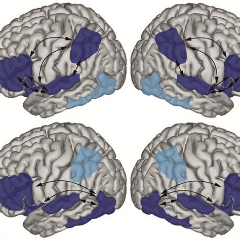 Schematic Of The Networks Affected By Working Memory Training Download Scientific Diagram