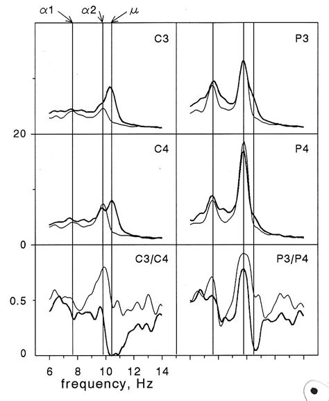 How Do We Analyze Eeg Data To Detect Whether Mu Wave Frequencies 8 13 Hz Were Present In One