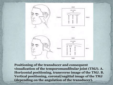 Imaging Of Tmj Pptx
