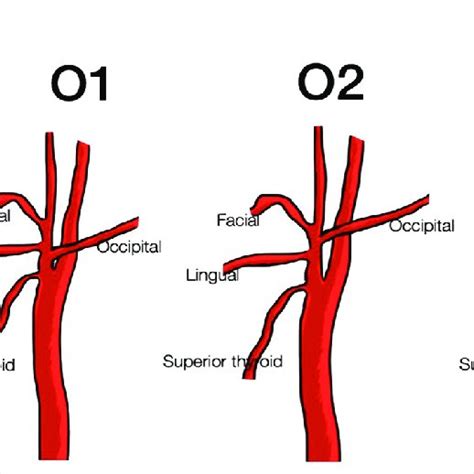 The Artistic Rendering Illustrates The Classification Of The Anterior