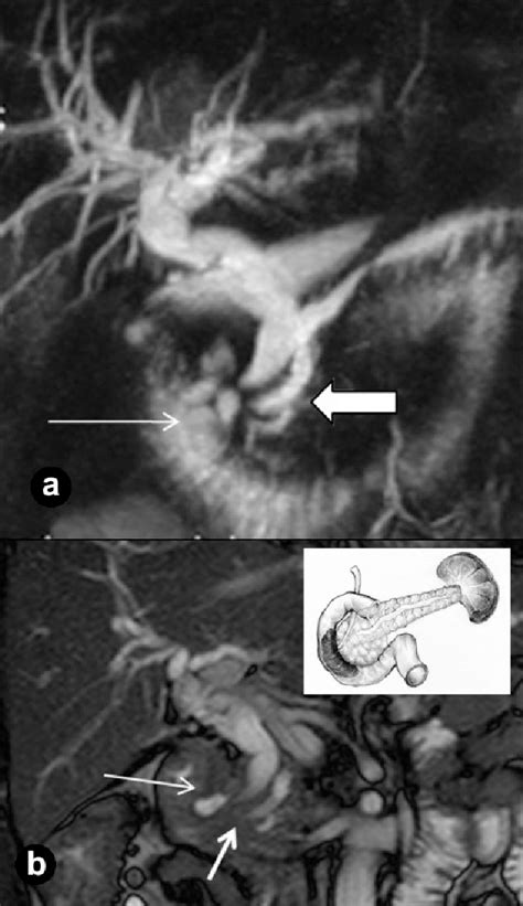 Magnetic Resonance Imaging Case 2 A Magnetic Resonance Download Scientific Diagram