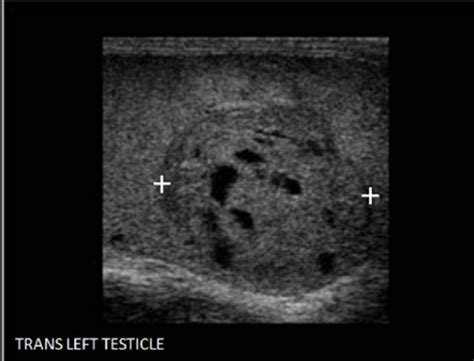 Physics Final Flashcards Quizlet