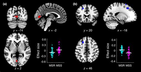 Functional Vestibular Network Involved In Motion Sickness Download Scientific Diagram