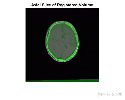 MATLAB图像处理 多模态 D医学图像配准 知乎