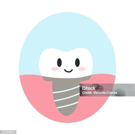 만화 플랫 스타일의 치과 치아 임플란트 캐릭터 잃어버린 치아 복원 치과 치료 개념 구강 위생의 벡터 일러스트 레이 션 가공의 인물에 대한 스톡 벡터 아트 및 기타 이미지