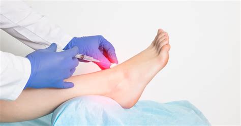 How Long Does Nerve Block Last VISPVascular Interventional Specialists Of Prescott