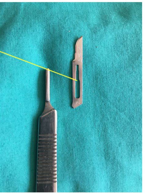 Diagram Of Scalpel Blade Anatomy Quizlet