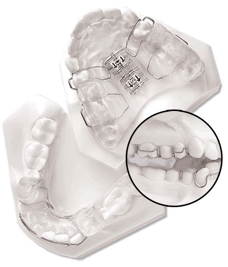 Twin Block Appliance Dynaflex
