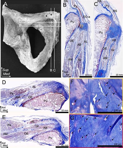 Histological Analysis Of The Tendinous Structure Attached To The Pubis