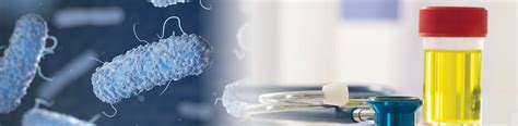 Introduction Of The Workflow For Uti In Microbiology Lab