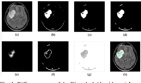 Figure 1 From Fpga Based Hardware Software Co Design To Accelerate Brain Tumour Segmentation