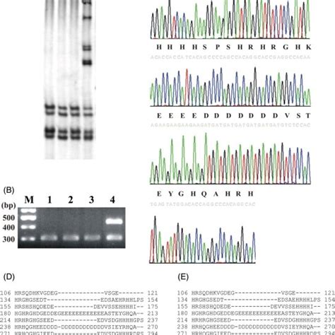 Representative Example Of Single Strand Conformational Polymorphism Download Scientific Diagram