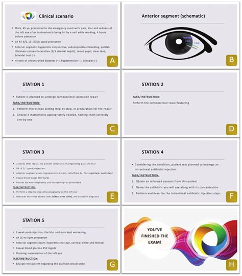 An Example Of Sequential Objective Structured Clinical Examination