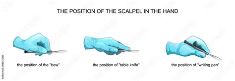 The Position Of The Scalpel In The Hand Stock Vector Adobe Stock