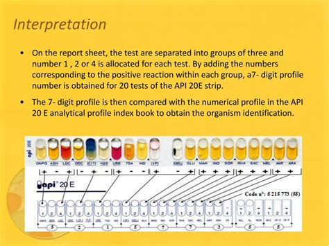 Ppt Api 20e Powerpoint Presentation Free Download Id 1935586