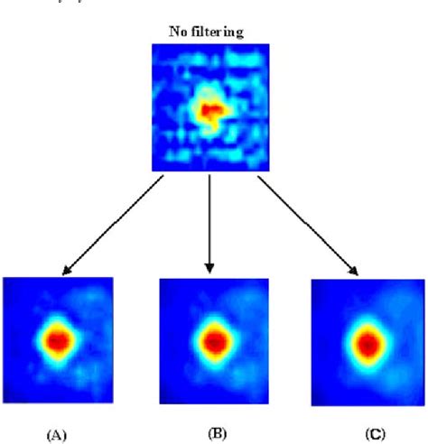 Figure 1 From Evaluation Of An Iterative Reconstruction Method For