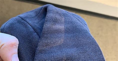 Spots Album On Imgur