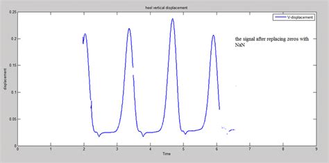 Whats The Best Method For Gap Fillingmissing Data In Motion Capture Data Researchgate