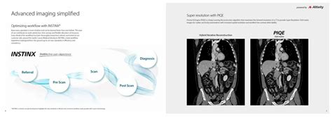 Canon Ct Scanner New At 30000000 In Nagpur ID 2855324815897