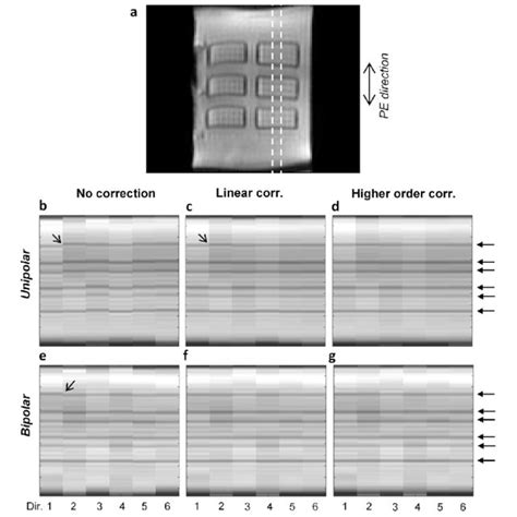 Phantom Images With Various Levels Of Eddy Current Correction A An