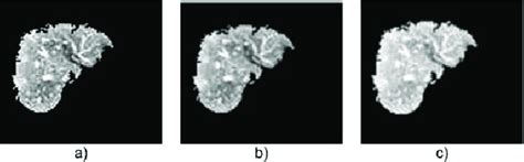 Postprocessing A Adaptive Histogram Equalization B Gaussian Download Scientific Diagram