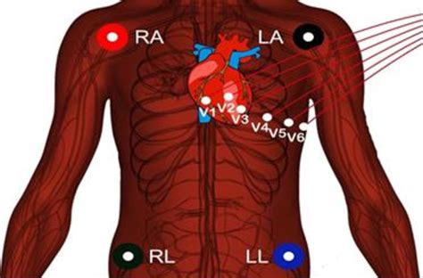 Figure 1 From A Review On Machine Transfer And Deep Learning Approaches For Ecg Classification