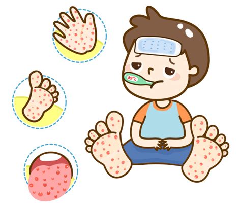 12 Ways To Prevent Hand Foot And Mouth Disease Ex Tremes