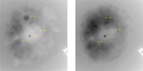 Hois Inspection Of Uninsulated External Corrosion Scabs